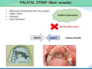 MAXILLARY MAJOR CONNECTOR.pptx