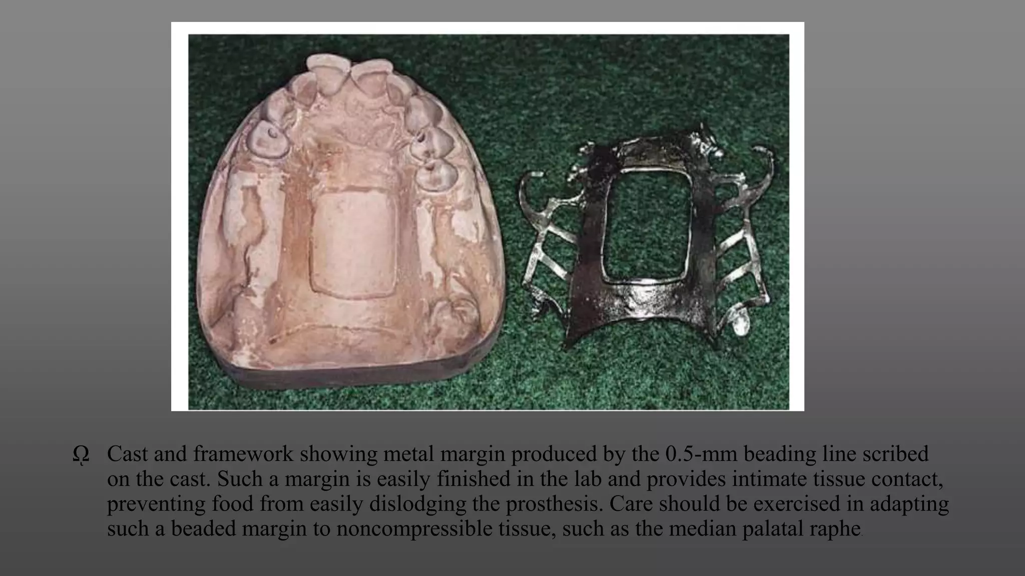 Maxillary major connectors | PPTX