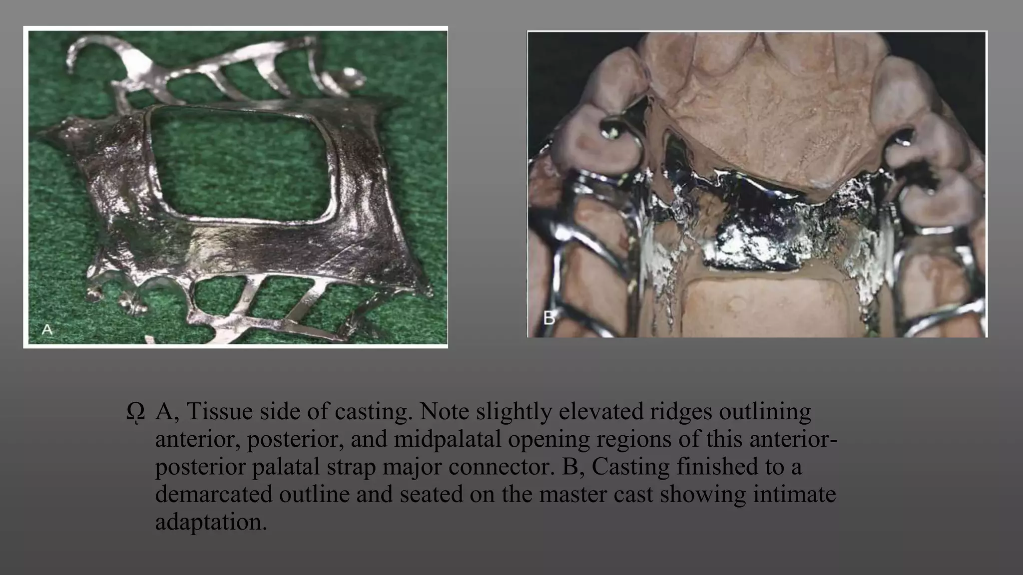 Maxillary major connectors | PPTX
