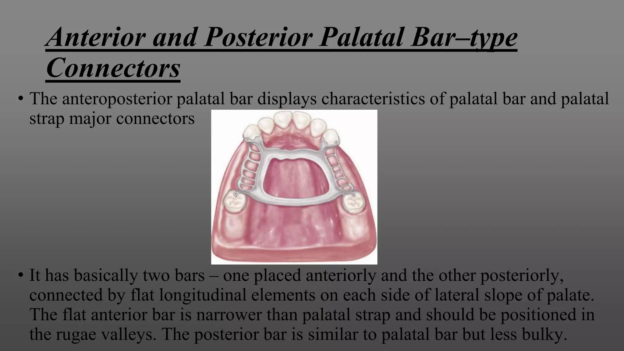 Maxillary major connectors | PPTX
