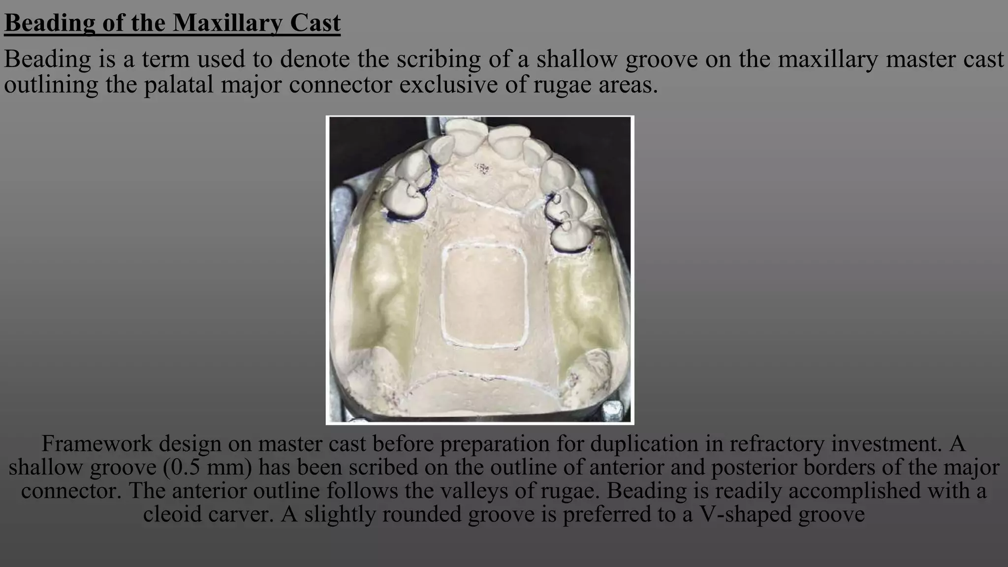 Maxillary major connectors | PPTX