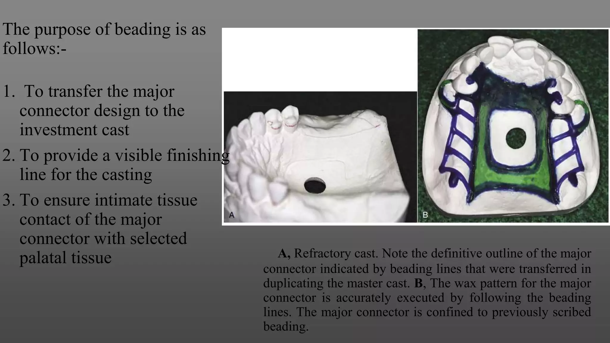 Maxillary major connectors | PPTX