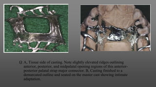Maxillary major connectors | PPTX
