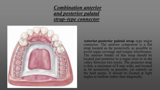Maxillary major connectors | PPTX