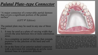 Maxillary major connectors | PPTX