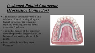 Maxillary major connectors | PPTX