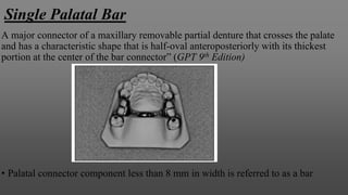 Maxillary major connectors | PPTX