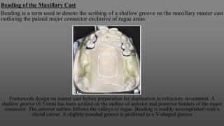 Maxillary major connectors | PPTX