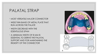 MAXILLARY MAJOR CONNECTORS IN CPD PROSTHO | PPTX