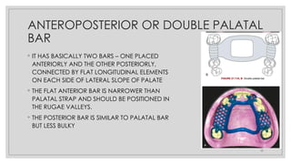 MAXILLARY MAJOR CONNECTORS IN CPD PROSTHO | PPTX