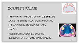 MAXILLARY MAJOR CONNECTORS IN CPD PROSTHO | PPTX