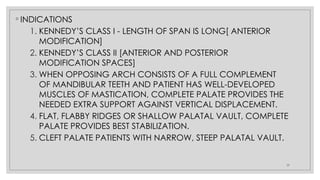 MAXILLARY MAJOR CONNECTORS IN CPD PROSTHO | PPTX
