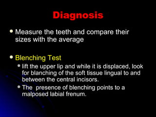 Maxillary median diastema | PPT
