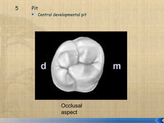morphology of maxillary 1st,2nd,3rd molar teeth | PPT