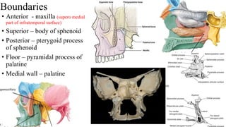 Maxillary nerve | PDF