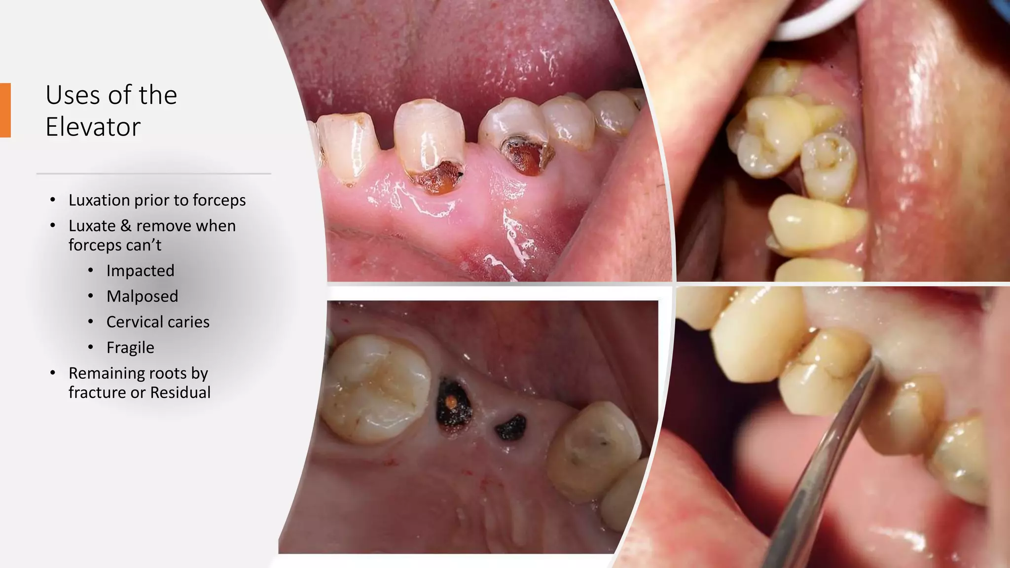 maxillary nerve.pptx