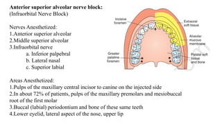 Maxillary nerve block | PPTX