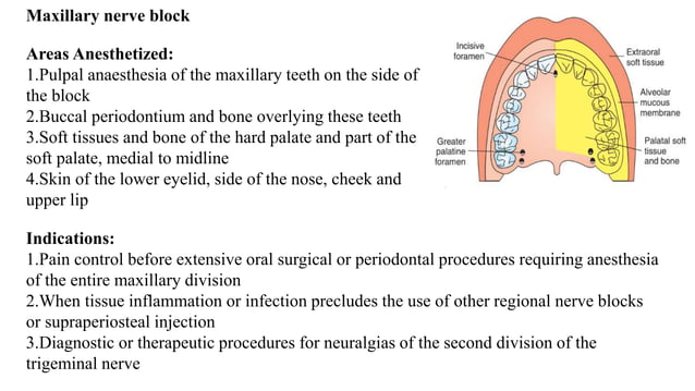 Maxillary nerve block | PPTX