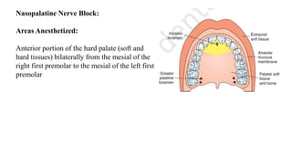 Maxillary Nerve Block