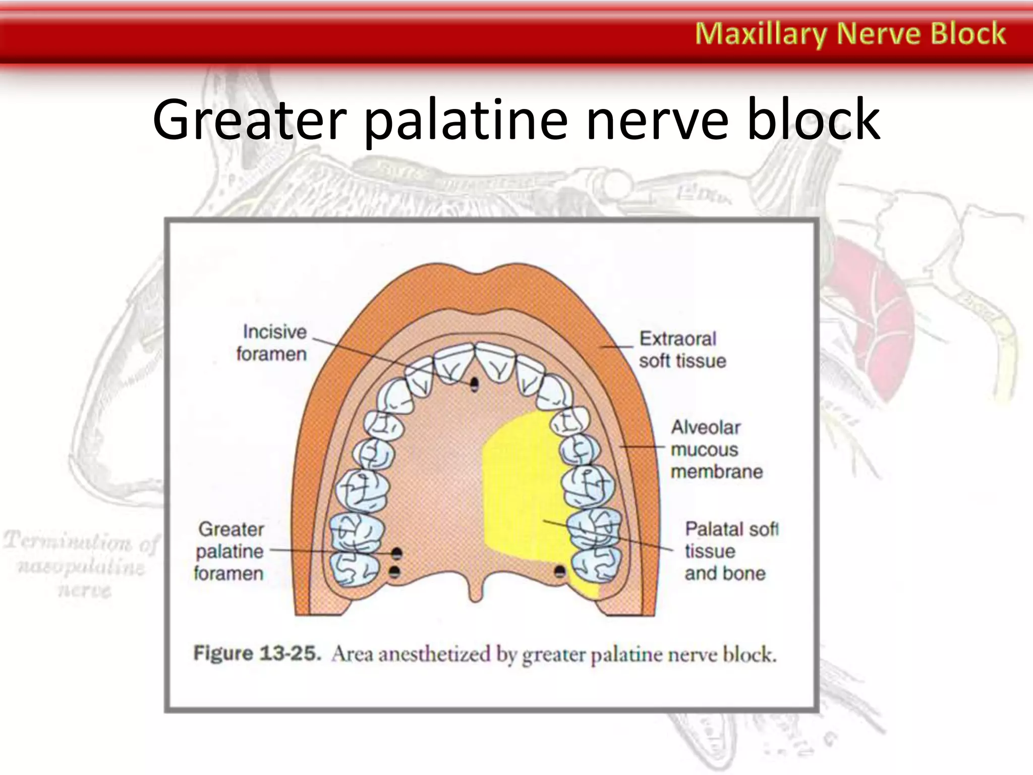 Maxillary nerve block.pptx