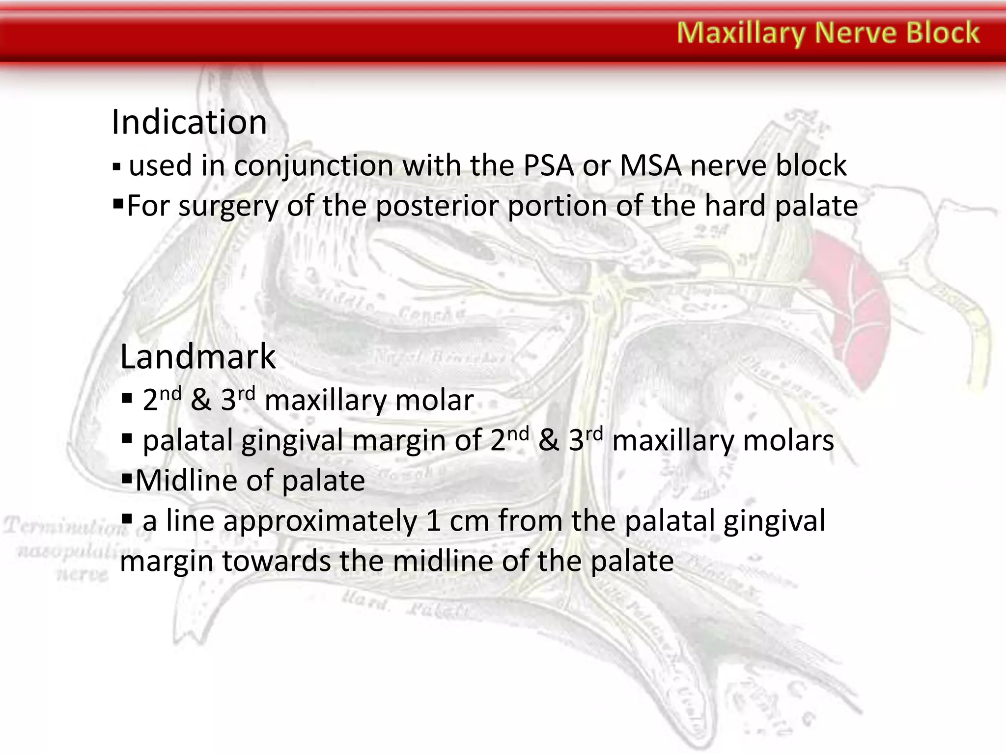 Maxillary nerve block.pptx