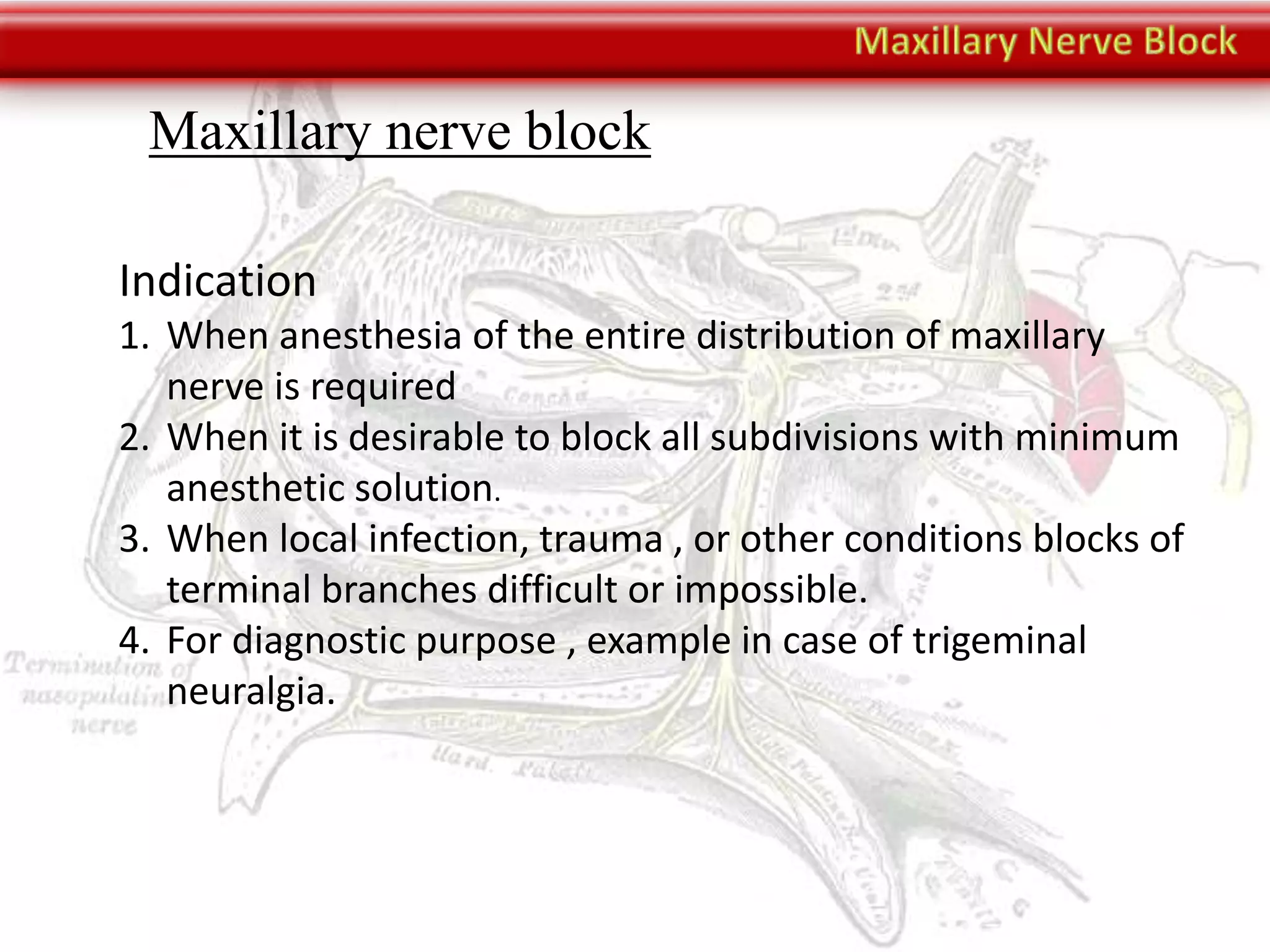 Maxillary nerve block.pptx