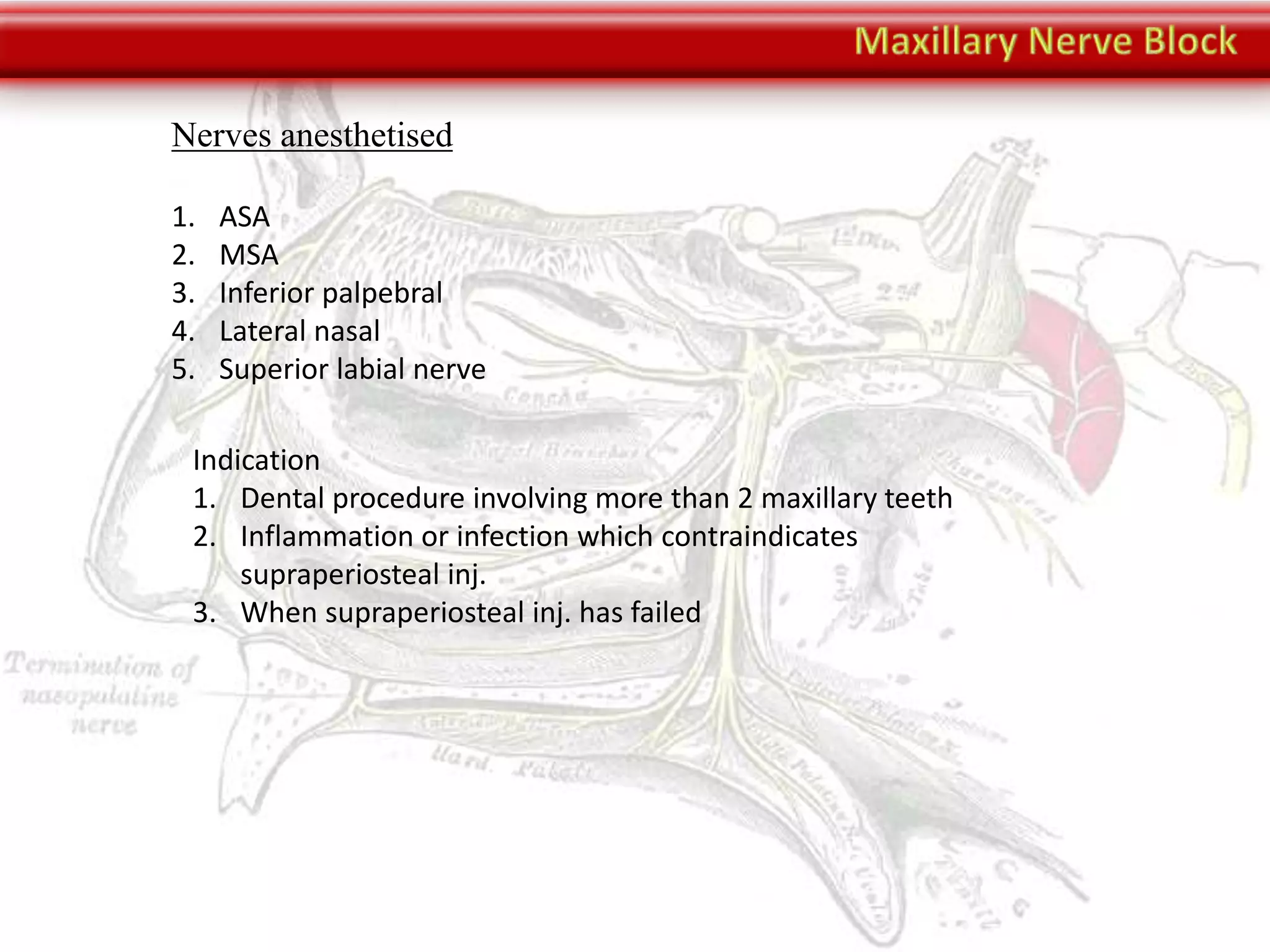 Maxillary nerve block.pptx