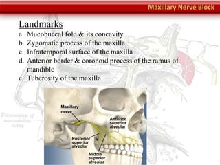 Maxillary nerve block.pptx