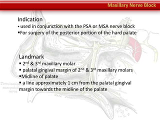 Maxillary nerve block.pptx