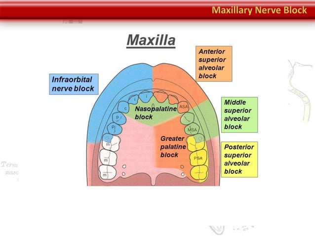 Maxillary nerve block.pptx