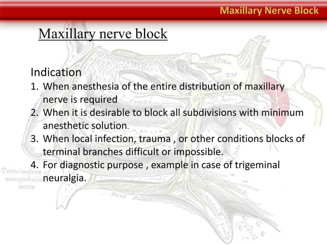 Maxillary nerve block.pptx