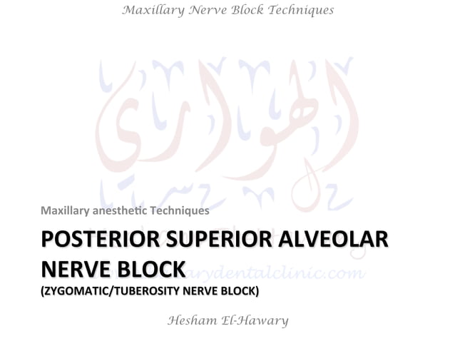 Maxillary nerve block anesthetic technique (with photos) | PDF | Ear ...