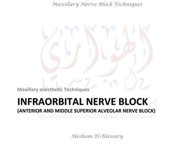 Maxillary nerve block anesthetic technique (with photos) | PDF | Ear ...