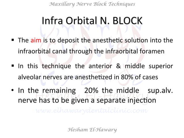 Maxillary nerve block anesthetic technique (with photos) | PDF | Ear ...