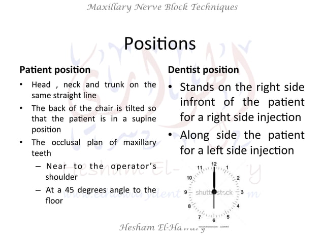 Maxillary nerve block anesthetic technique (with photos) | PDF | Ear ...