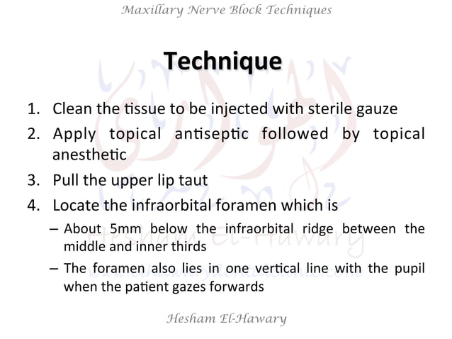 Maxillary nerve block anesthetic technique (with photos) | PDF | Ear ...