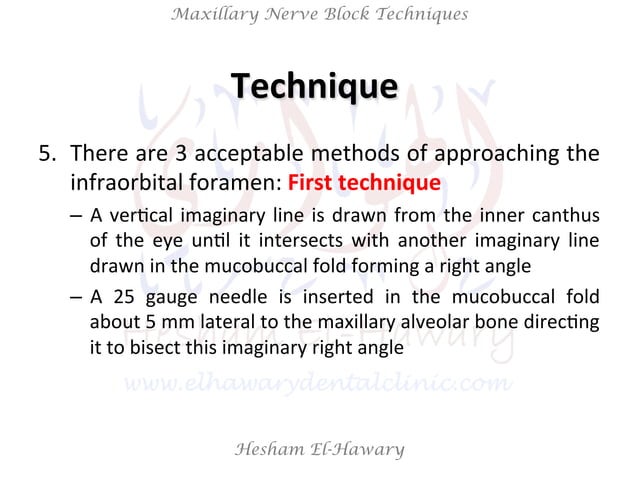 Maxillary nerve block anesthetic technique (with photos) | PDF | Ear ...