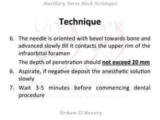 Maxillary nerve block anesthetic technique (with photos) | PDF