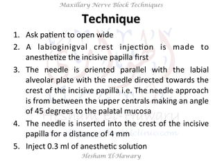 Maxillary nerve block anesthetic technique (with photos) | PDF