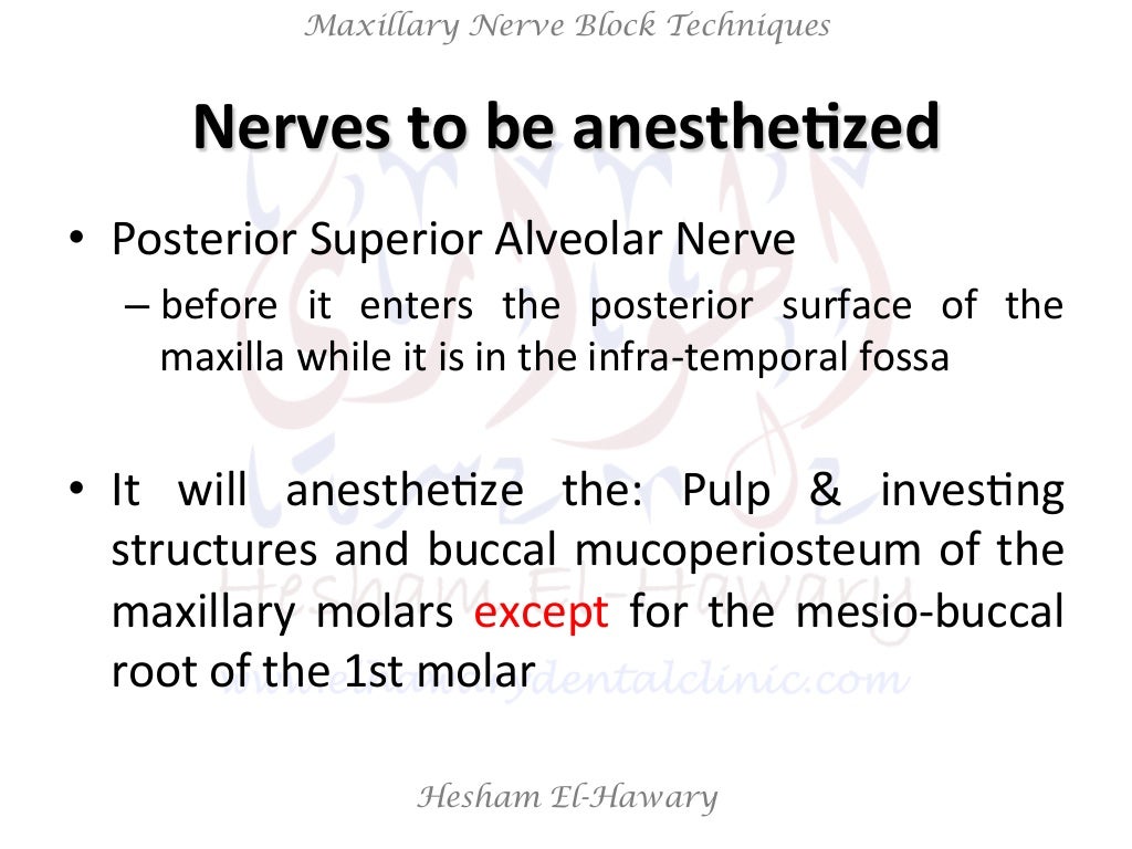 Maxillary Nerve Block Anesthetic Technique With Photos
