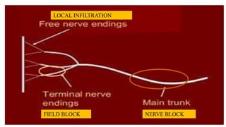MAXILLARY NERVE BLOCKS.pptx