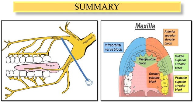 MAXILLARY NERVE BLOCKS.pptx | Ear, Nose and Throat Conditions ...