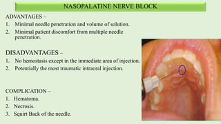 MAXILLARY NERVE BLOCKS.pptx