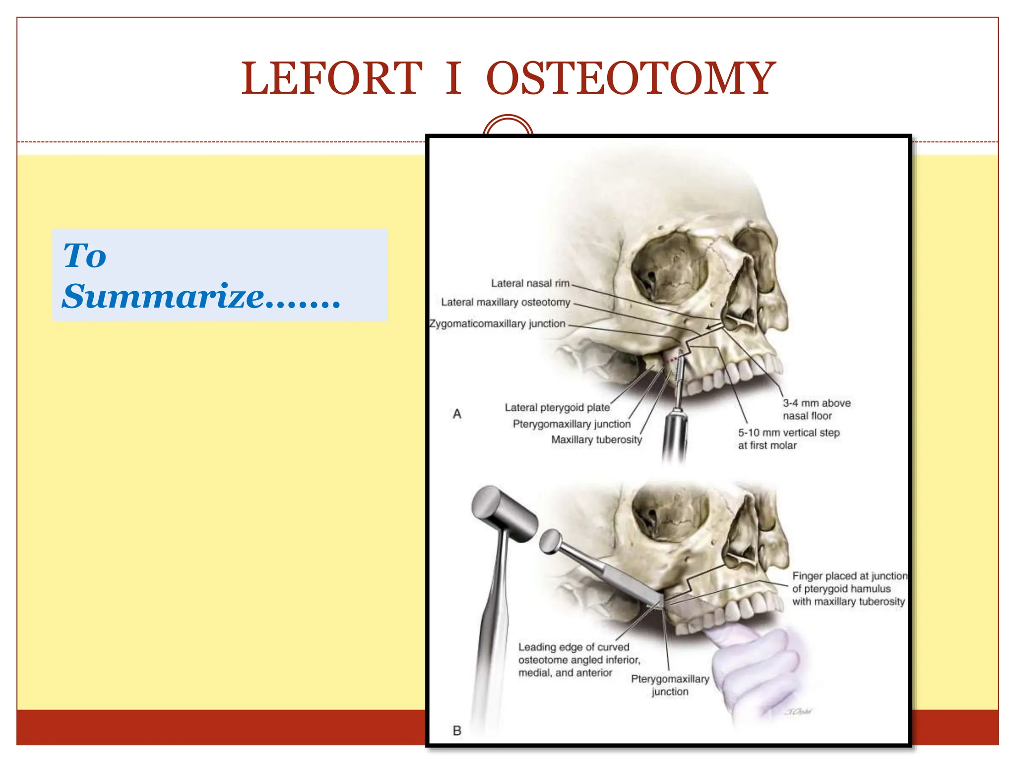 MAXILLARY ORTHOGNATHIC PROCEDURES AND SOFT TISSUE CHANGES-2.pptx