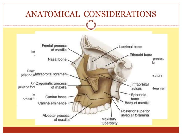 MAXILLARY ORTHOGNATHIC PROCEDURES AND SOFT TISSUE CHANGES-2.pptx ...