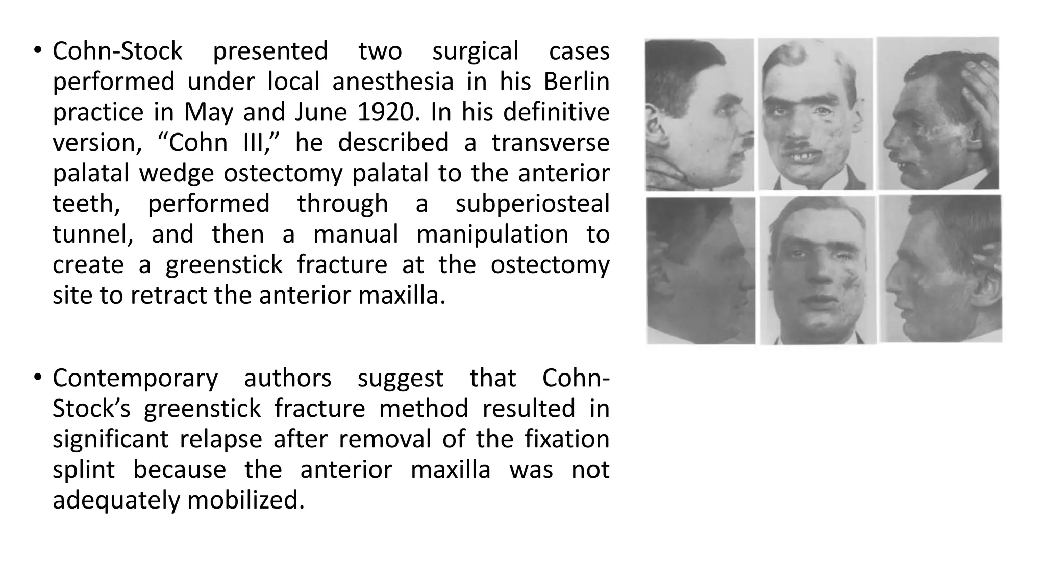 Maxillary Orthognathic Surgery | PPTX