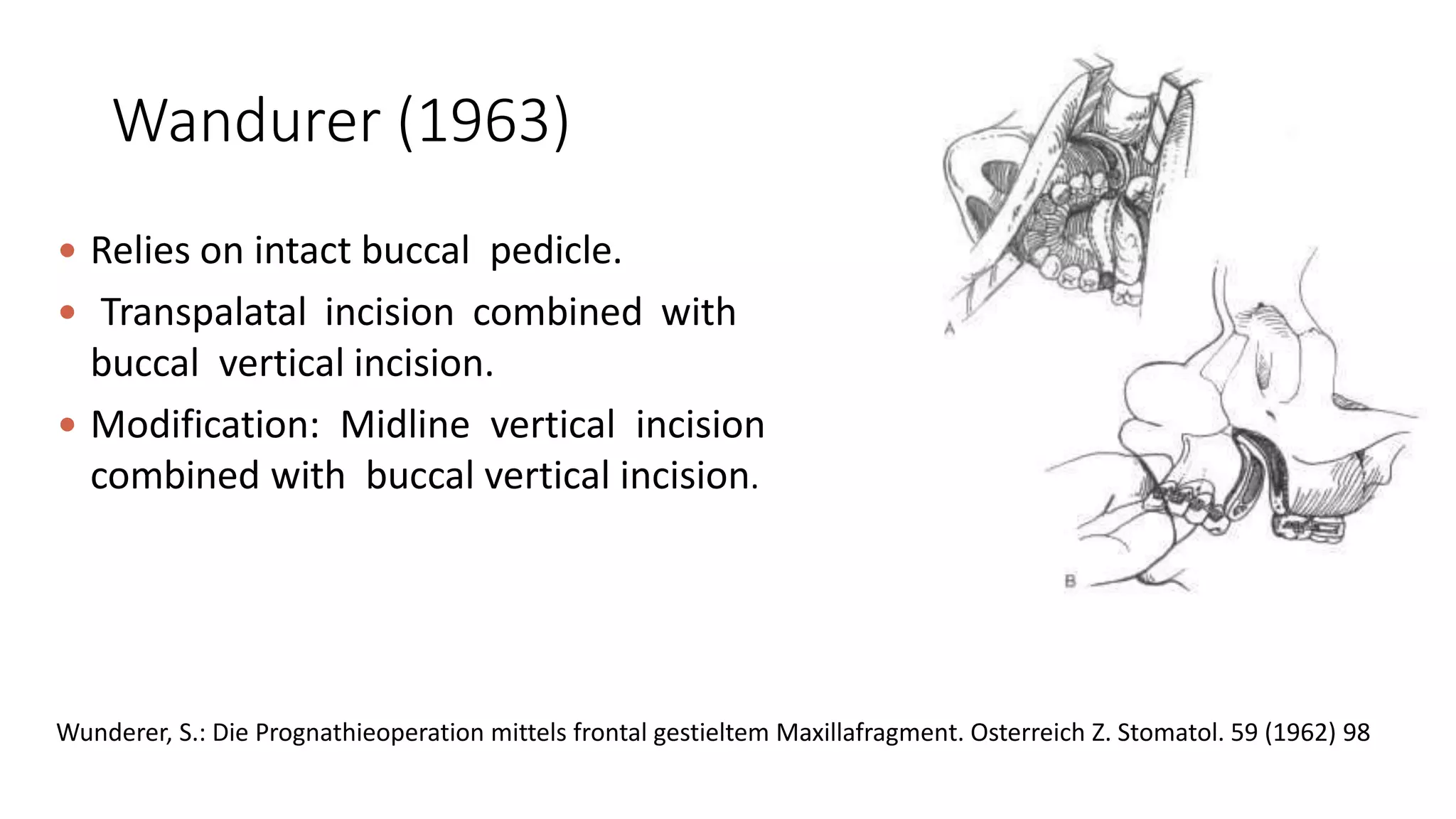 Maxillary Orthognathic Surgery | PPTX