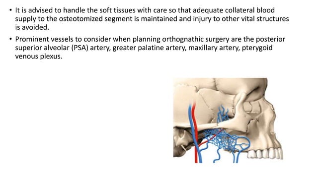 Maxillary Orthognathic Surgery | PPTX | Dental Health | Diseases and ...