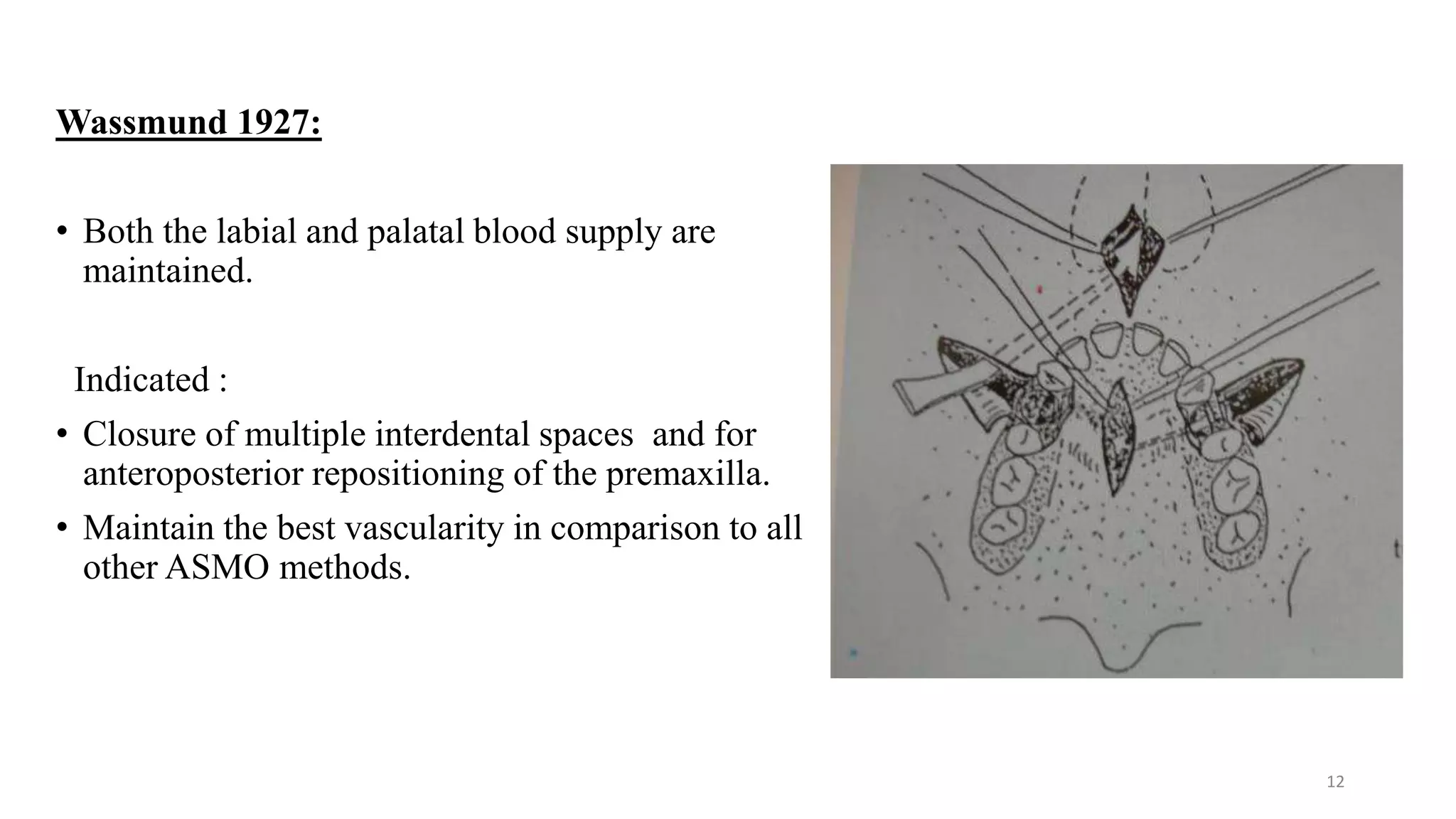 Maxillary osteotomies procedure | PPTX