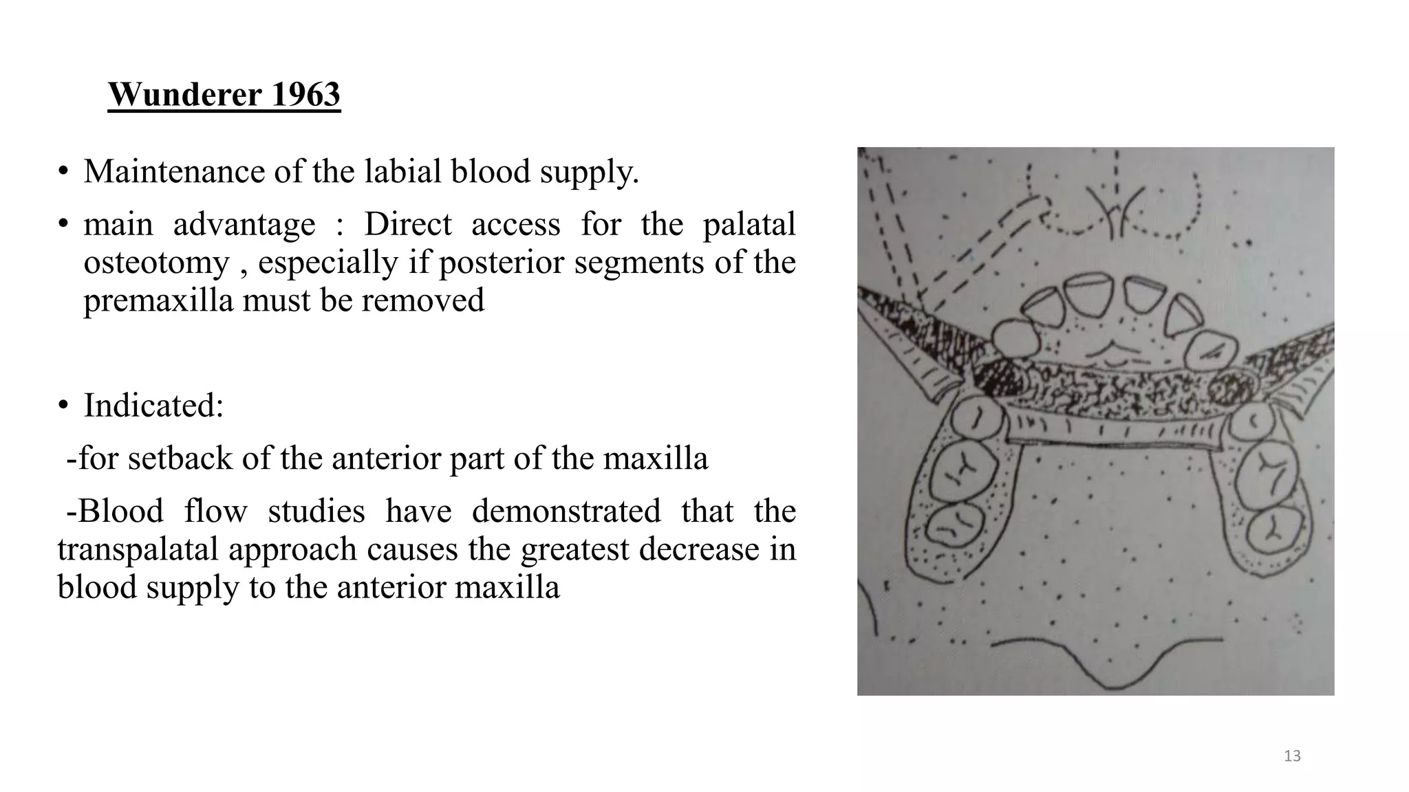 Maxillary osteotomies procedure | PPTX